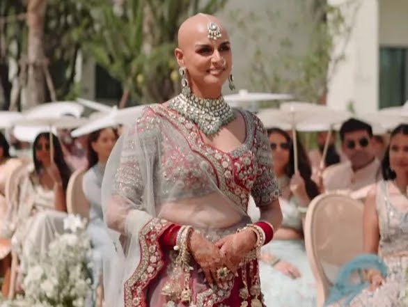 Bald and Beautiful: Indian Bride Ditches Wig, Flaunts Alopecia on ...
