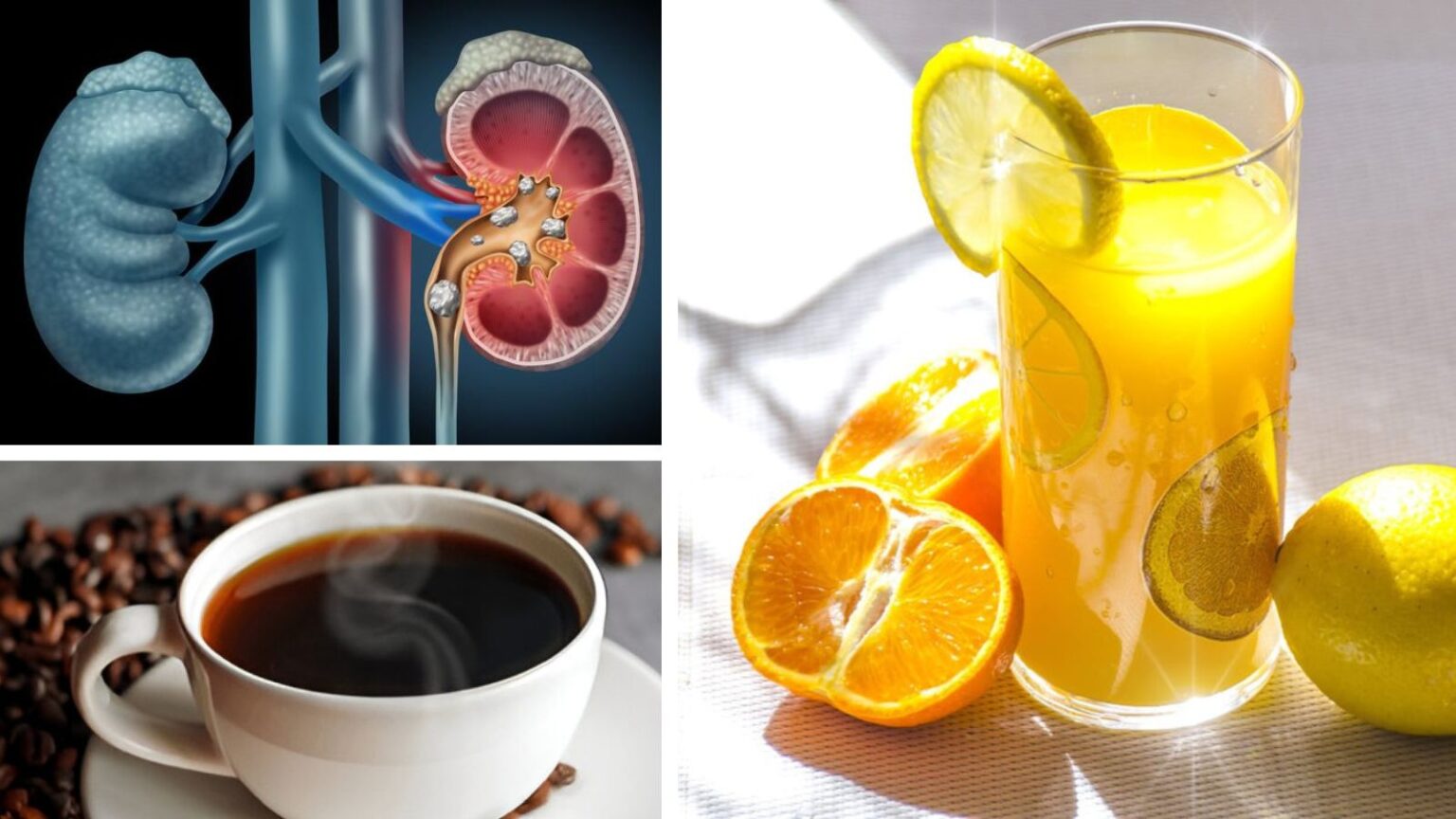 5 Refreshing Drinks That Can Help Prevent Kidney Stones - PUNE PULSE